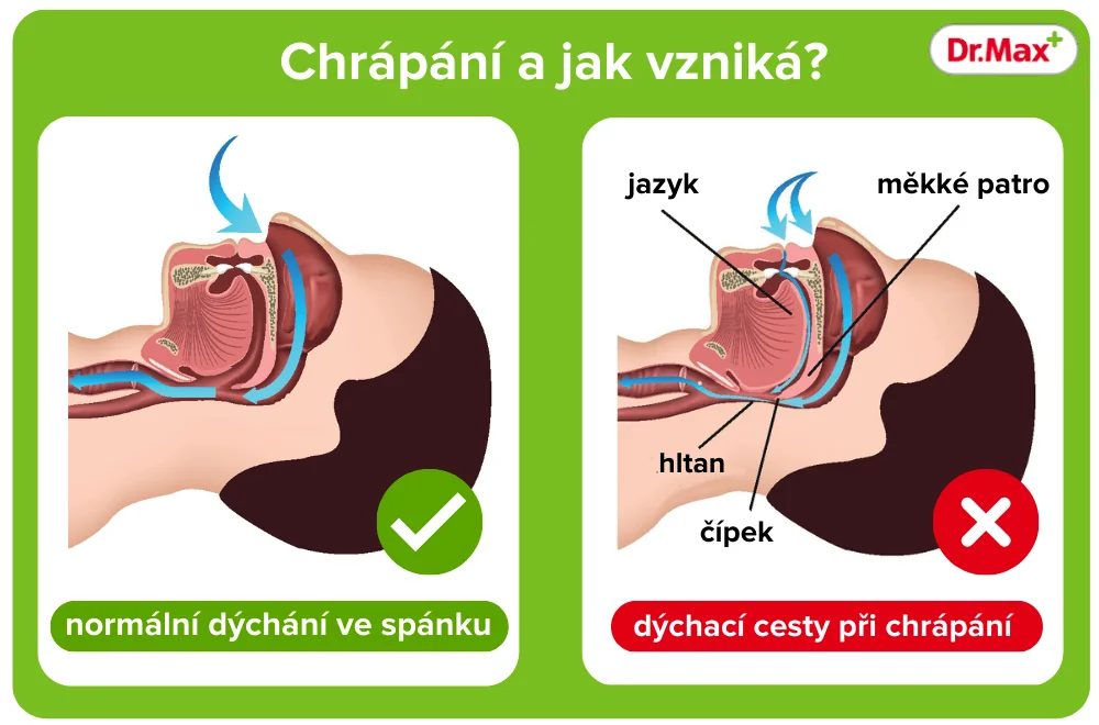 Chrápání – příčiny, diagnostika a léčba | Dr. Max lékárna